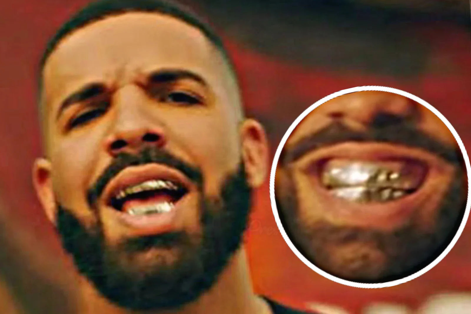 Drake Gold Grillz: How Much Did Drizzy Pay For His "In My Feelings ...