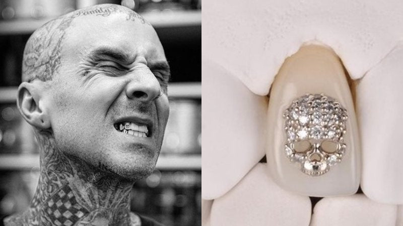 Travis Barker Custom Grillz - Cost + How to Order – Luxe Grillz