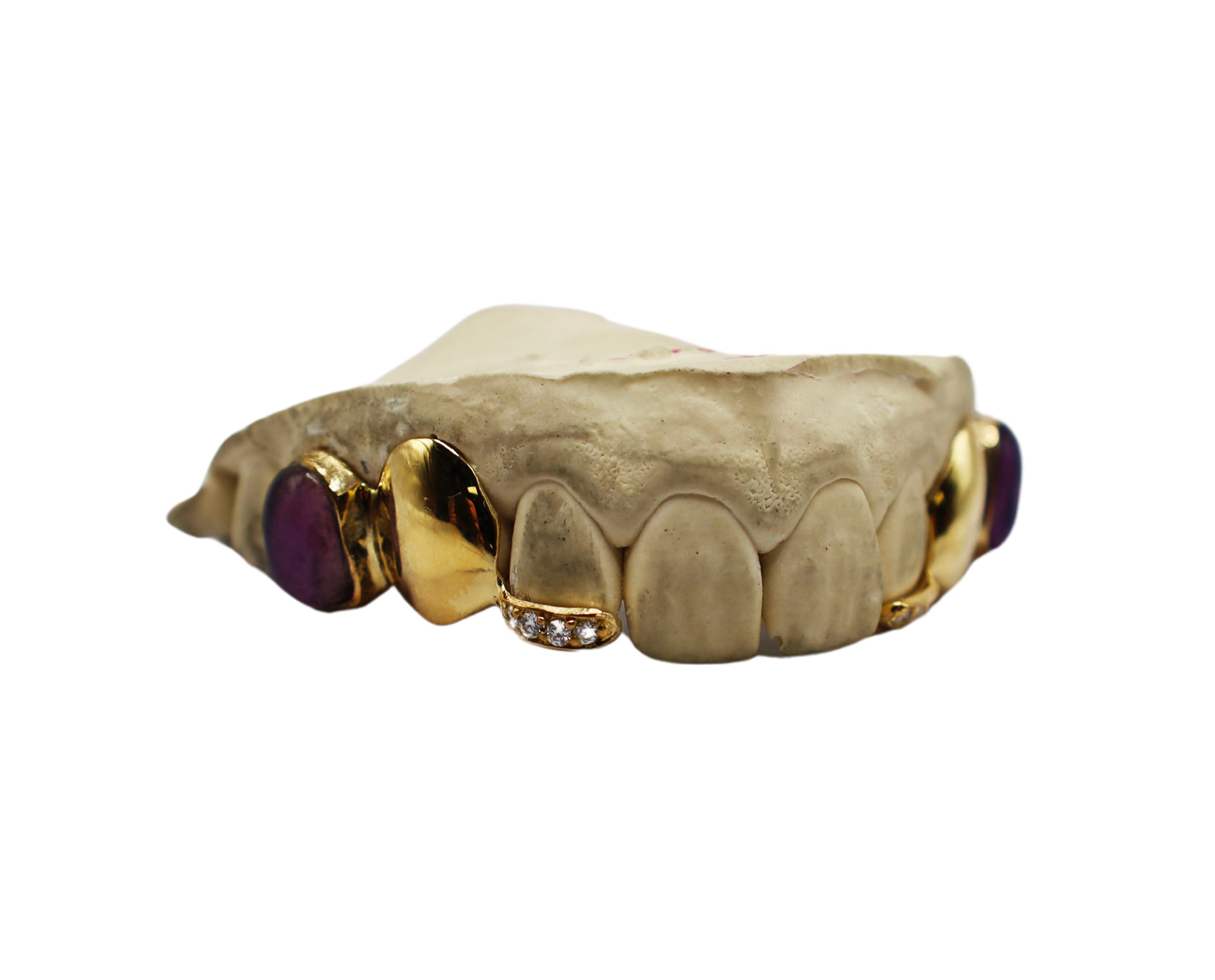 Buy Custom Amethyst Molar Grillz w Floating Diamond Tips – Luxe Grillz