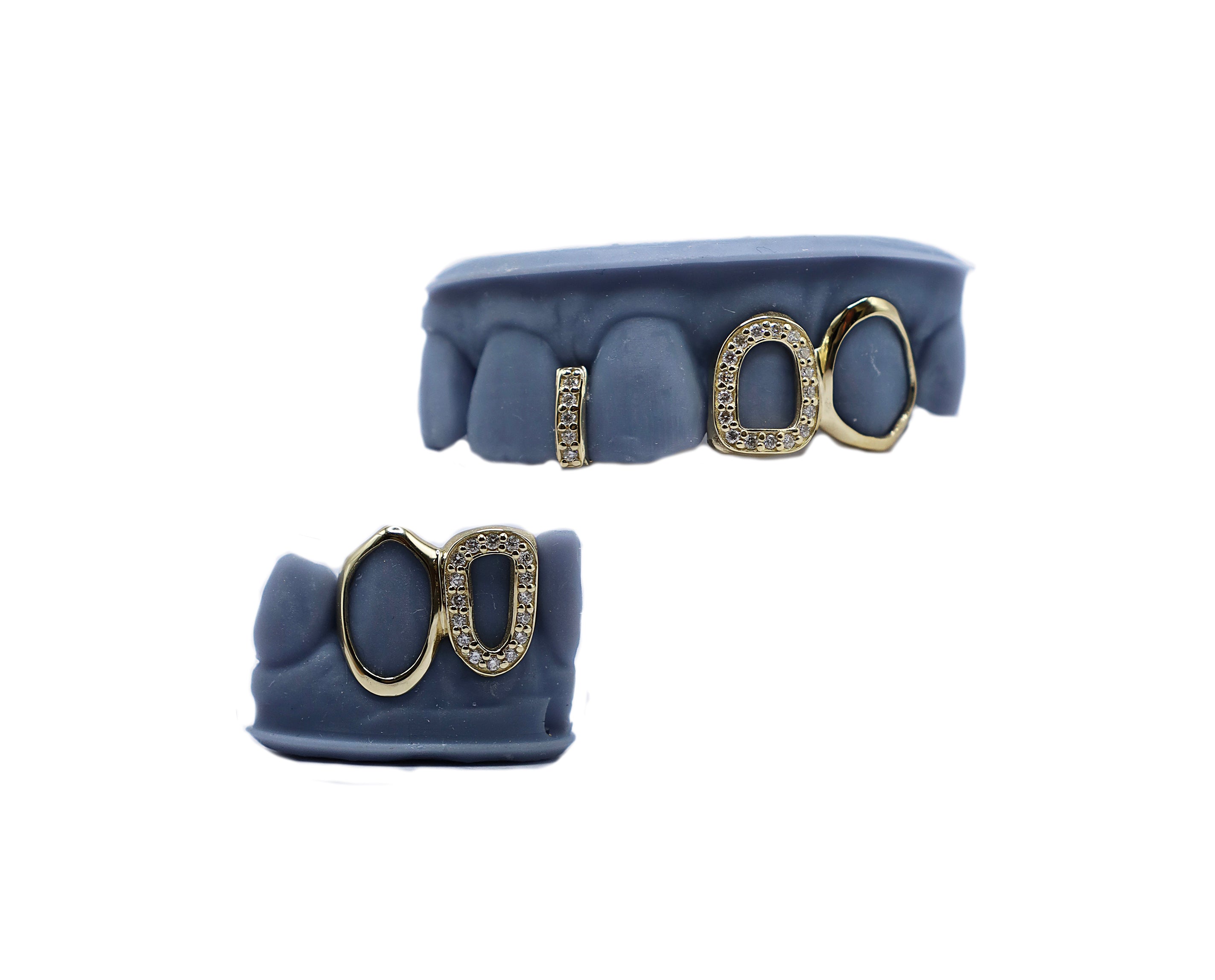 Diamond Open Face Combo w Gap and Fangs - Luxe Grillz