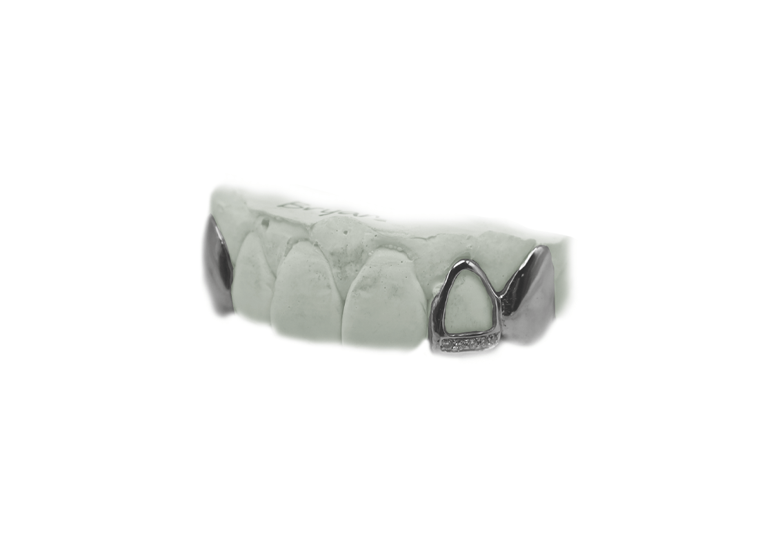 Open Tooth Grillz W/ Diamond Tip - Luxe Grillz