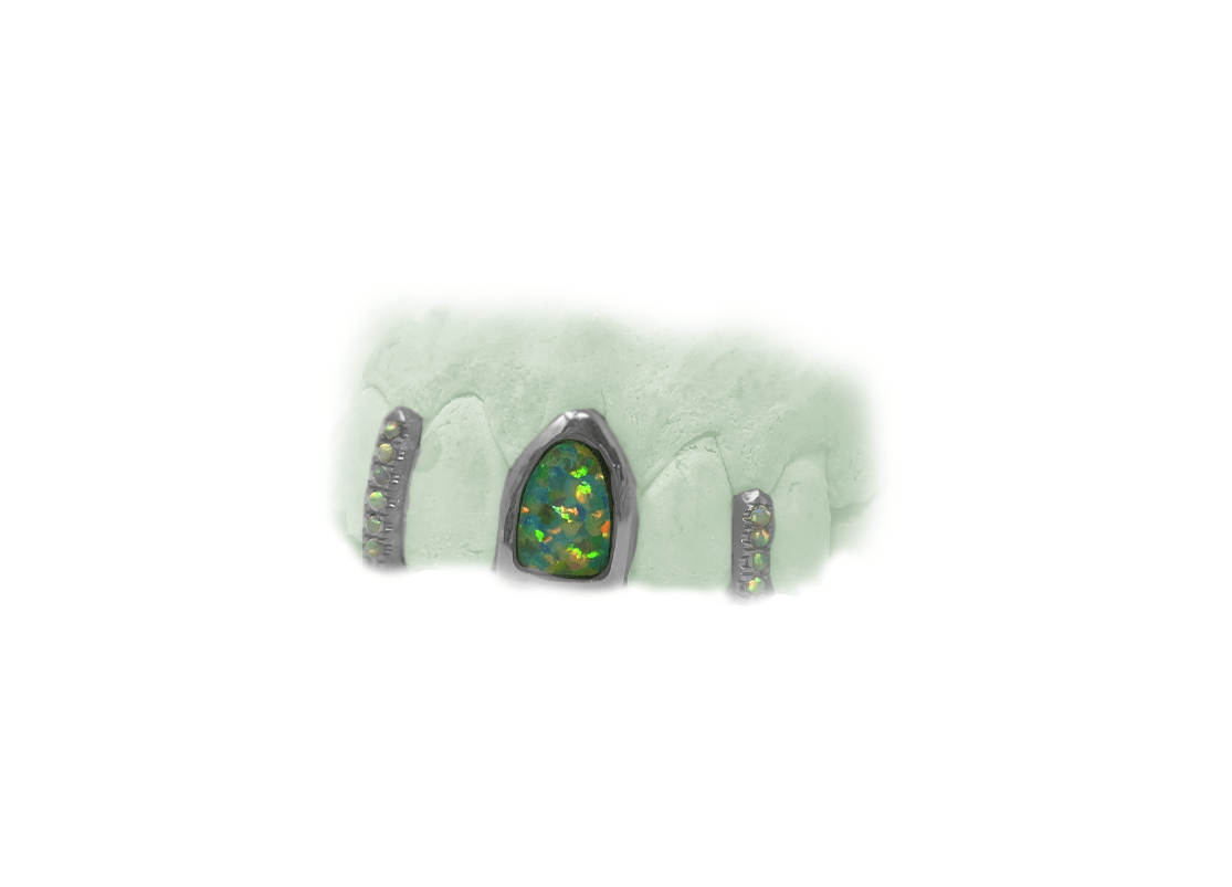 Buy Double Opal Gap Grillz w Opal Inlay Tooth - Real Gold – Luxe Grillz