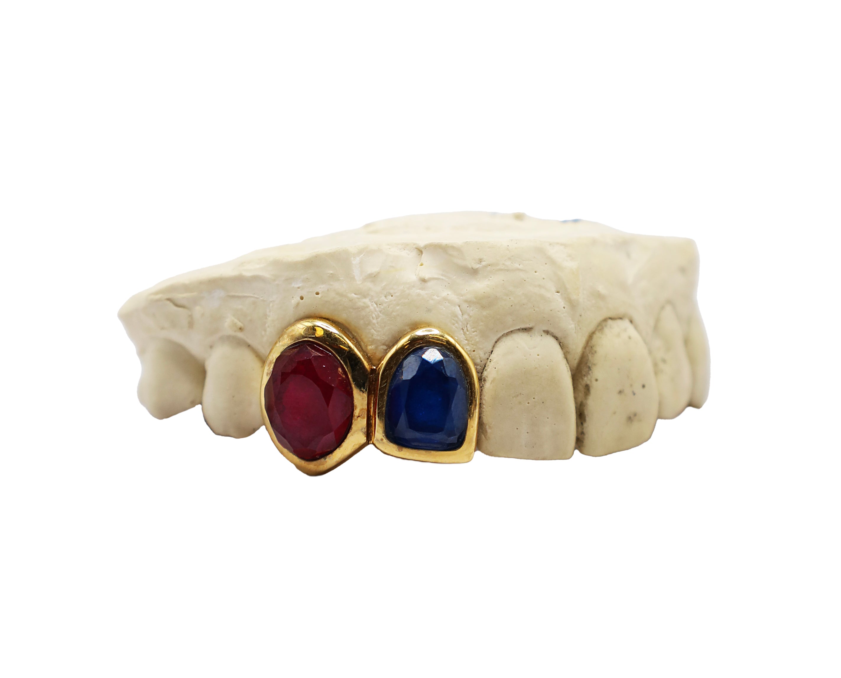 Gemstone Two Tooth Grillz Set - Luxe Grillz