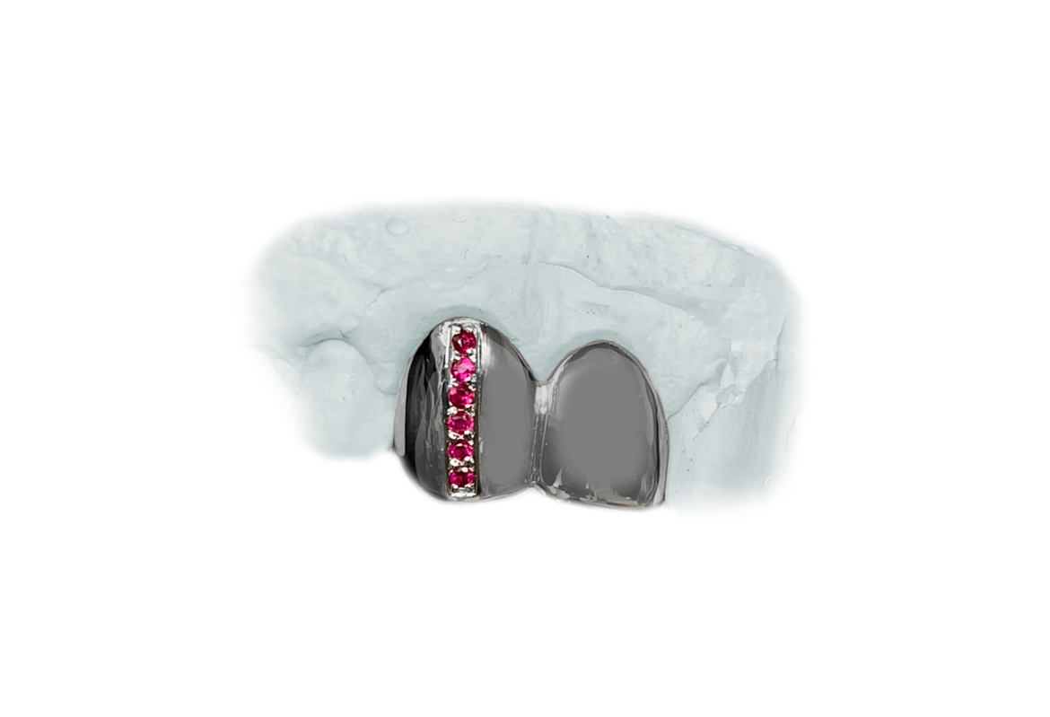 Two Teeth Grillz w Rubies on Fang – Luxe Grillz