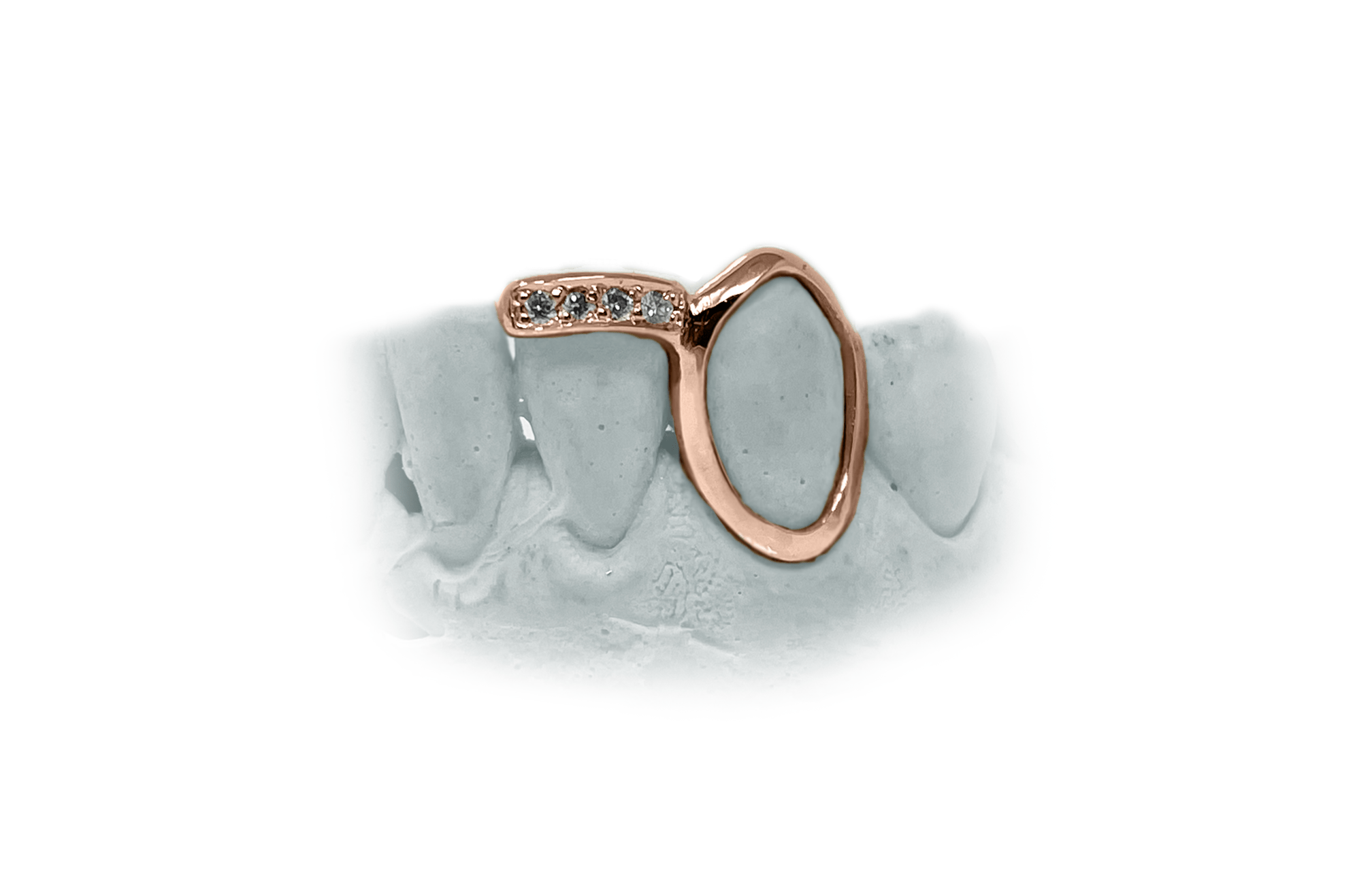 Floating Diamond Two Teeth Grillz – Luxe Grillz