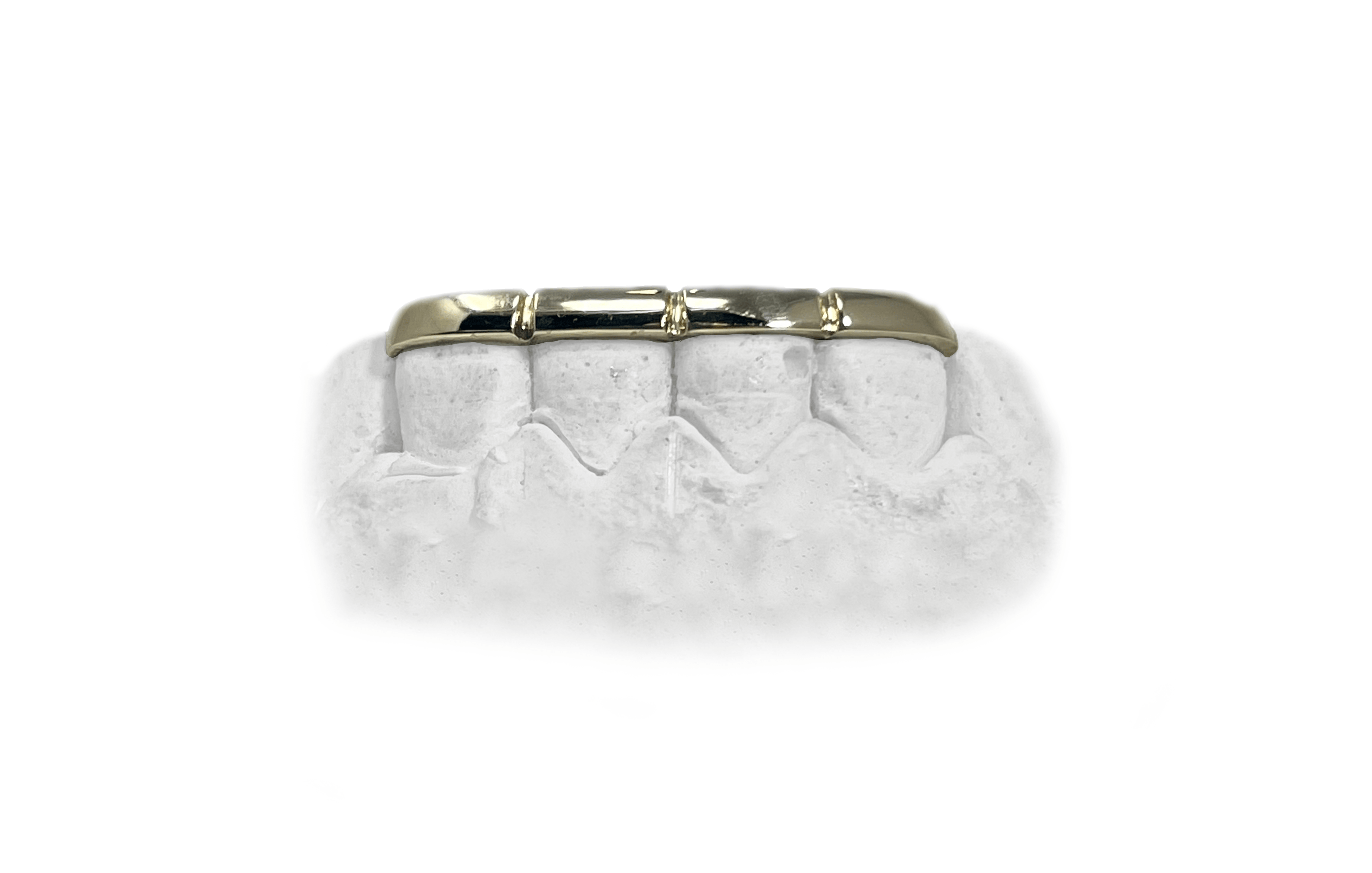 Buy Bottom 4 Bridge Grillz in 14K Yellow Gold - Solid Gold – Luxe Grillz
