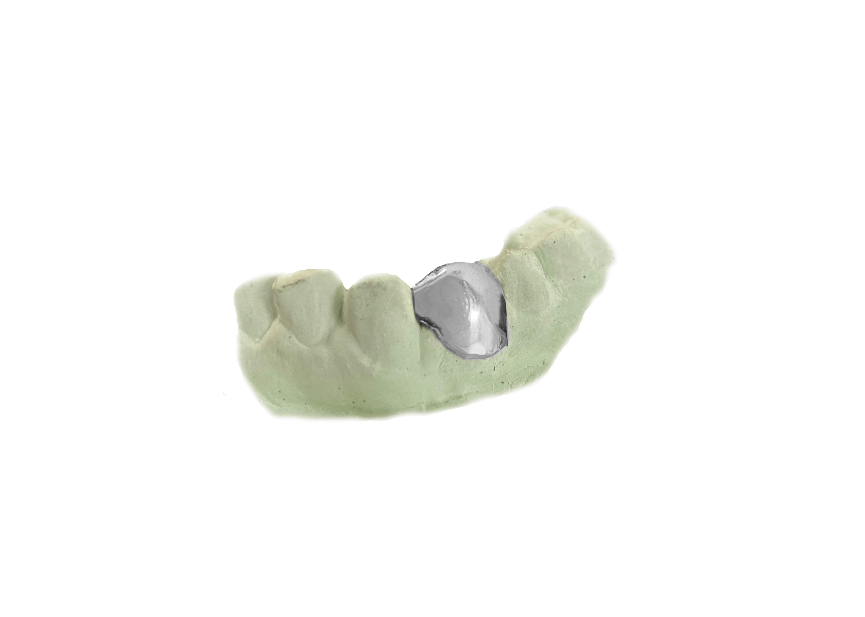 Single Tooth Grillz 10K White Gold - Luxe Grillz