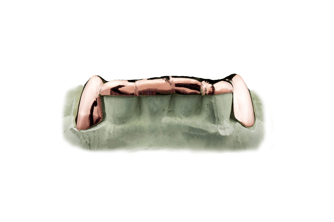 Bottom 6 Bridge Grillz 10K Rose - Luxe Grillz