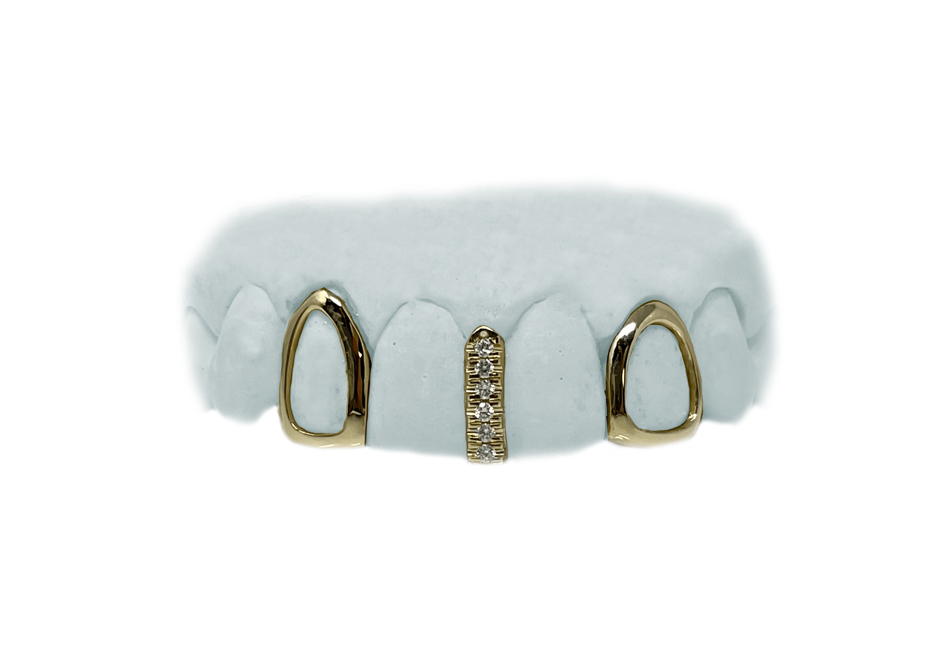 Buy Kim K Diamond Gap Grillz w Two Open Face Teeth – Luxe Grillz