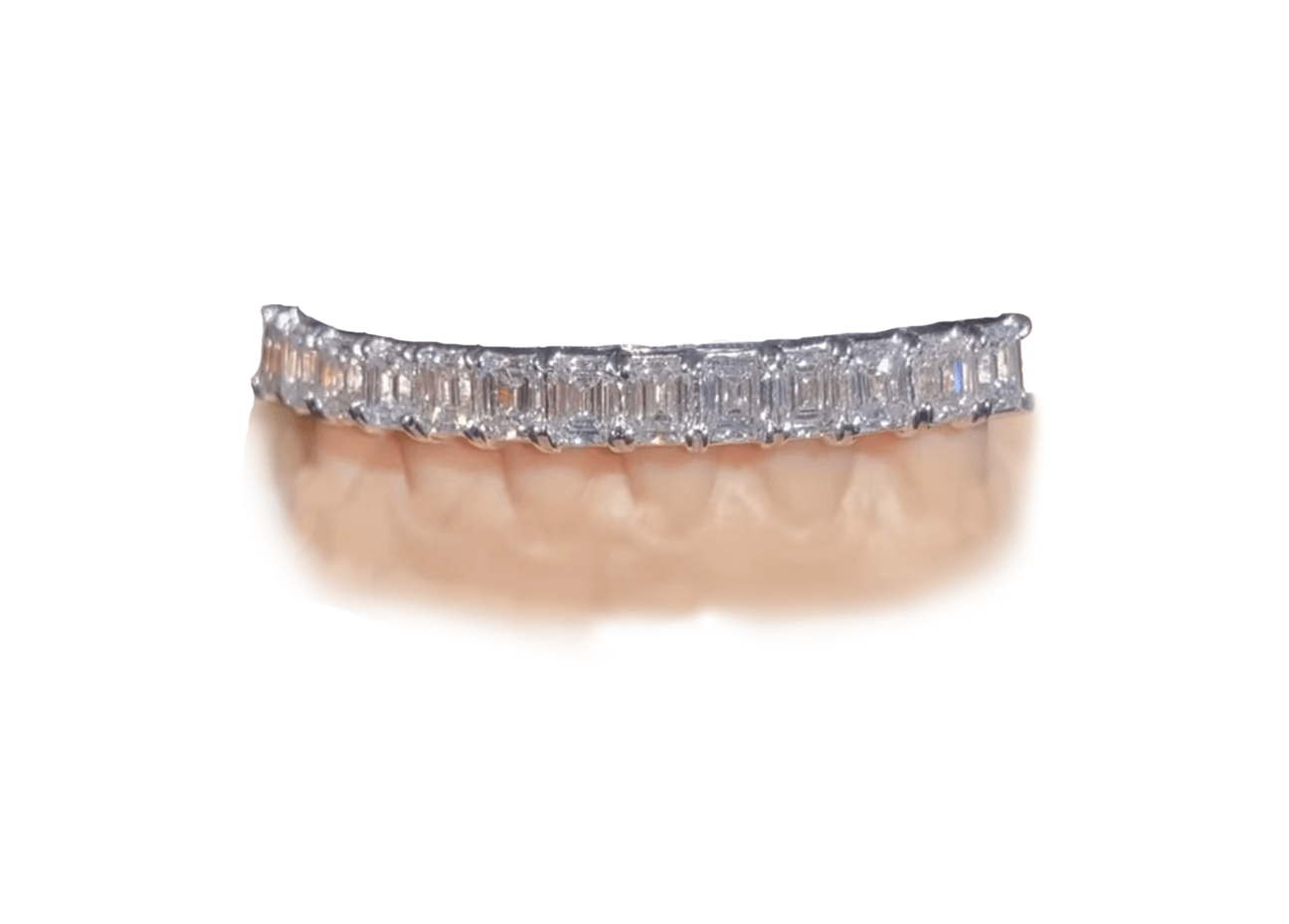 Kim K Emerald Grillz 14K White - Luxe Grillz