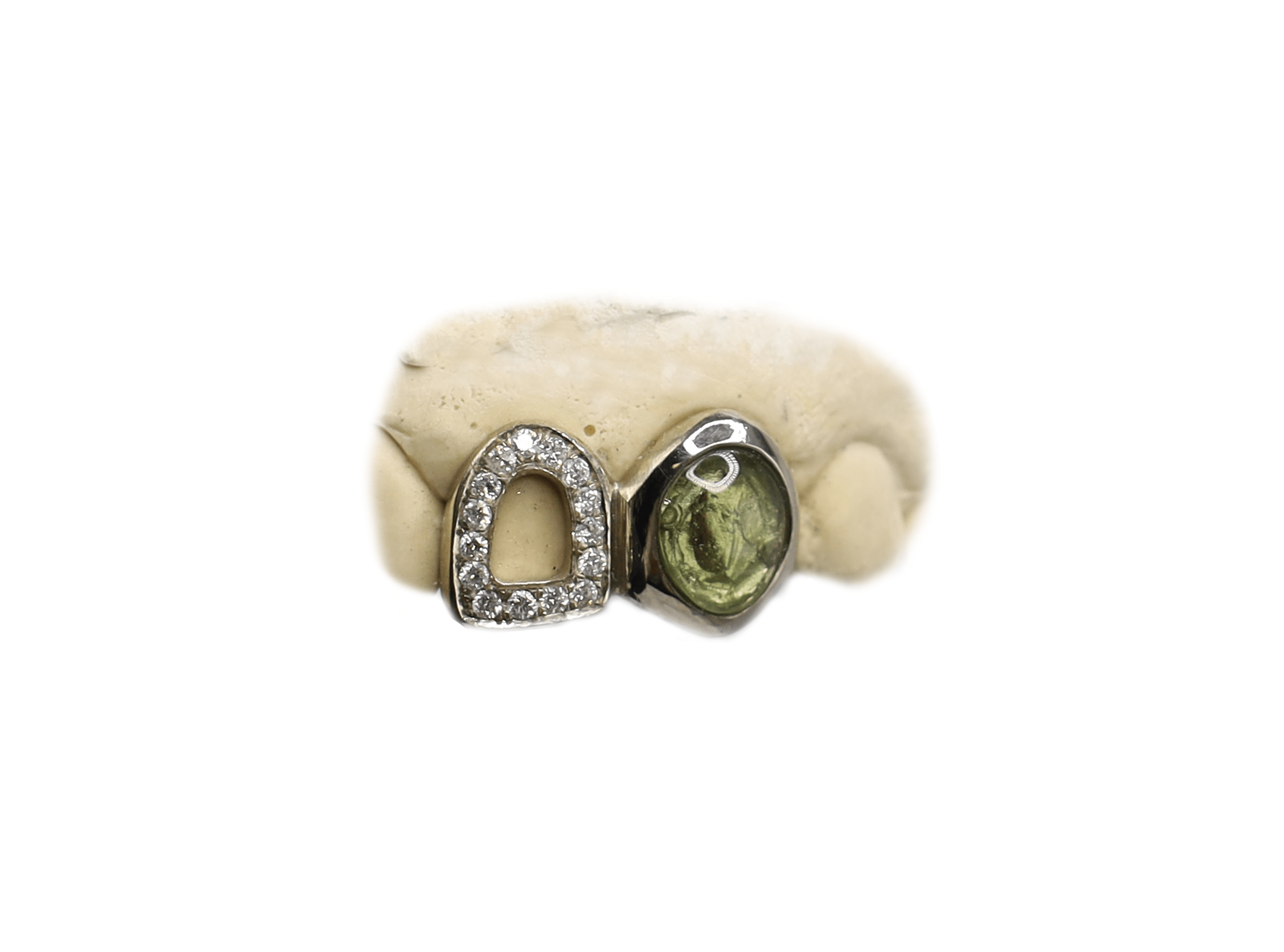 Peridot Diamond Two Teeth Grillz – Luxe Grillz