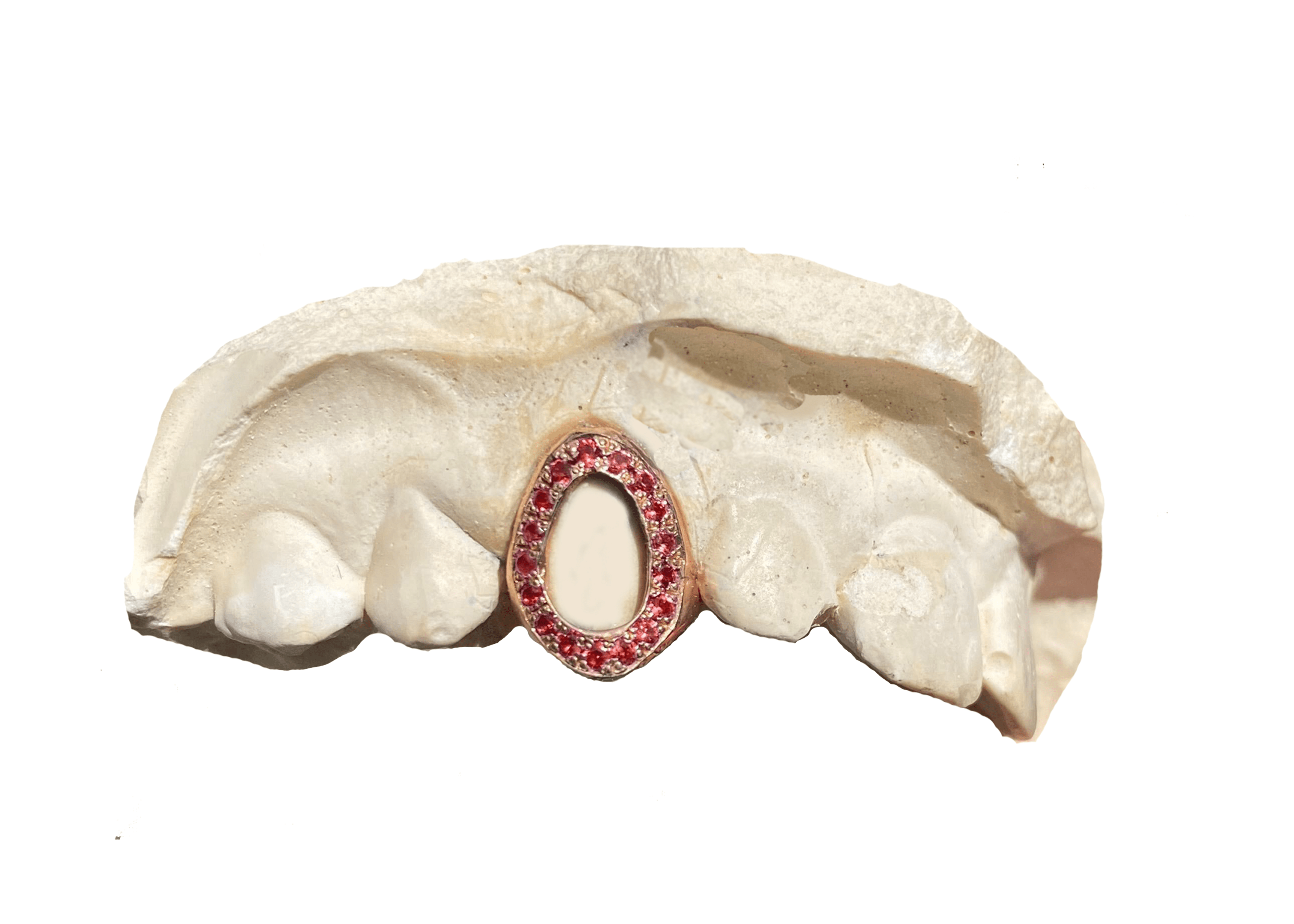 Ruby Open Face Rose Gold Grillz – Luxe Grillz