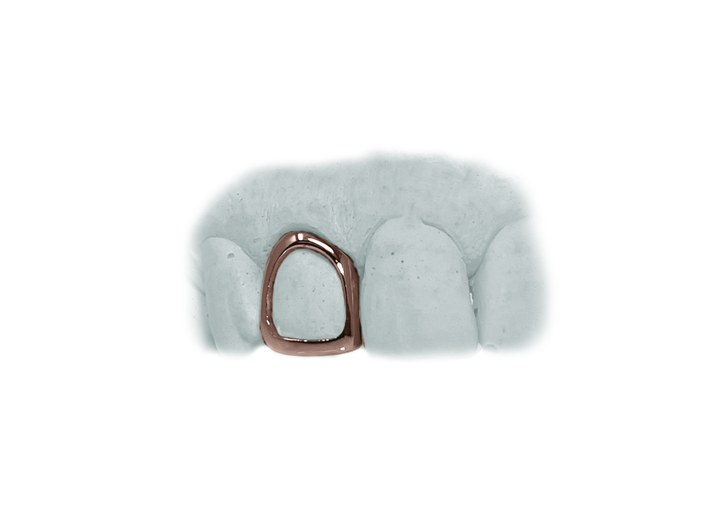 Shop Single Tooth Open Face Grillz | 100% Authentic - Luxe Grillz