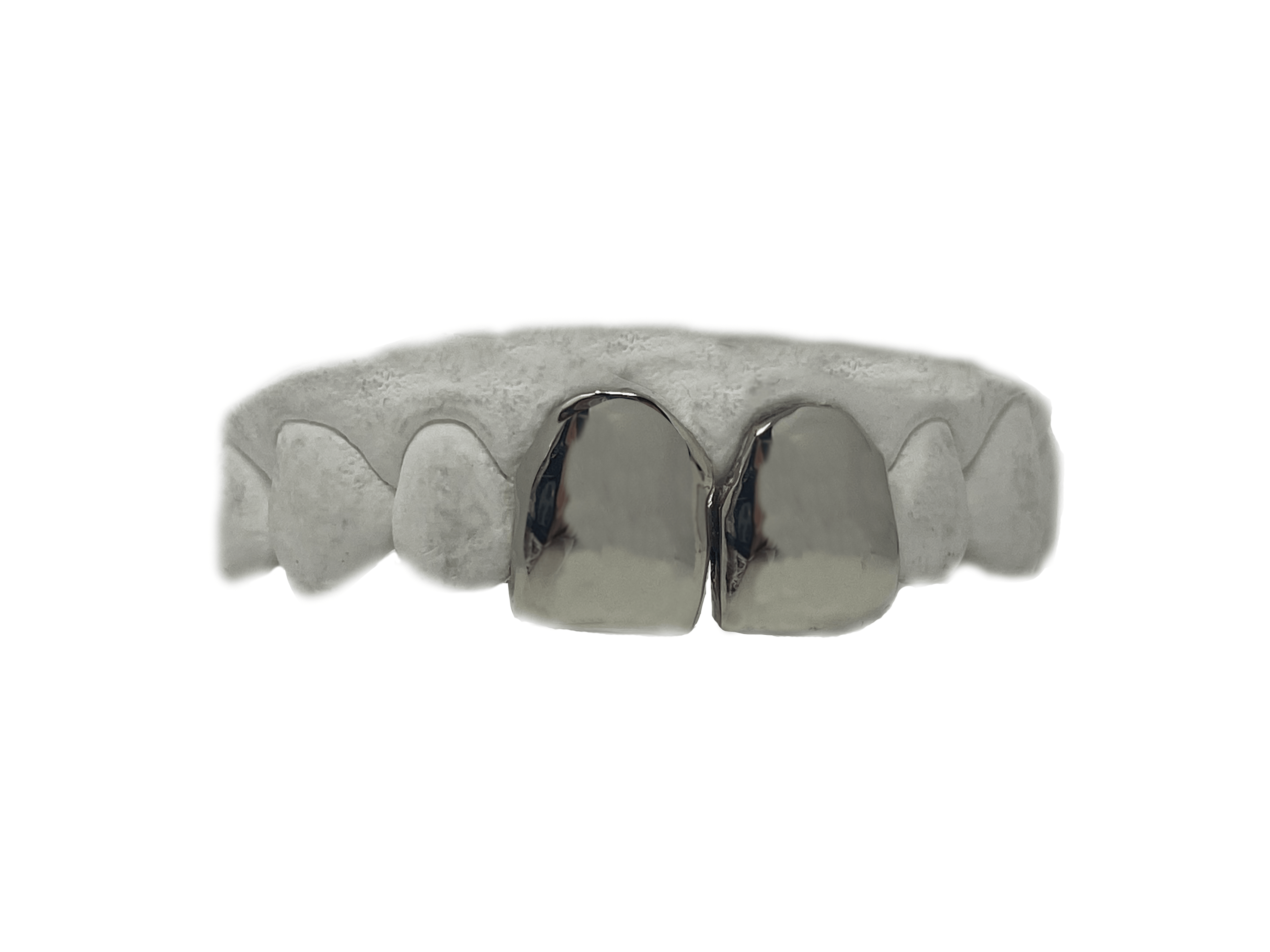 Buy Two Front Teeth Grillz 10K White Gold - (Double Cap) – Luxe Grillz